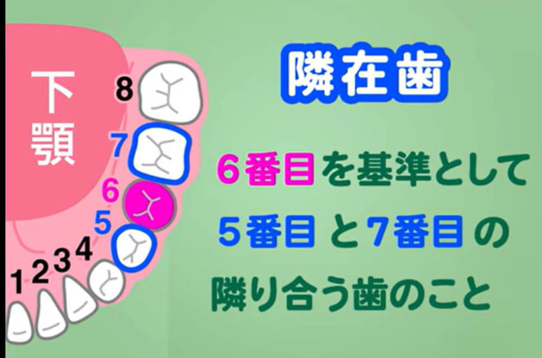 歯が欠損したらそのまま放置しては絶対ダメ！3つの対処法を詳しく解説 - 八尾市の歯医者、インビザライン矯正なら、アリオ八尾のマイデンタルクリニック、リノアス診療所のもりかわ歯科