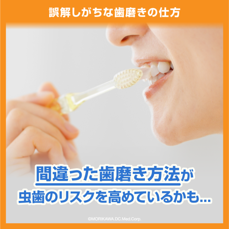 虫歯になりやすい場所、見落としがちな場所を徹底解説