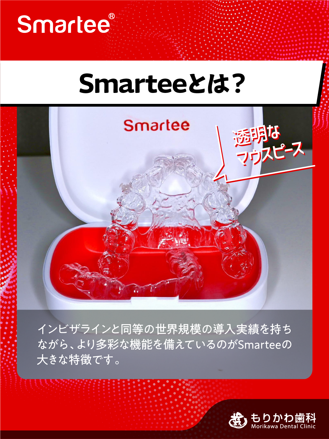 もりかわ歯科の新マウスピース矯正『Smartee』徹底解説｜インビザラインとの違いと最新治療法